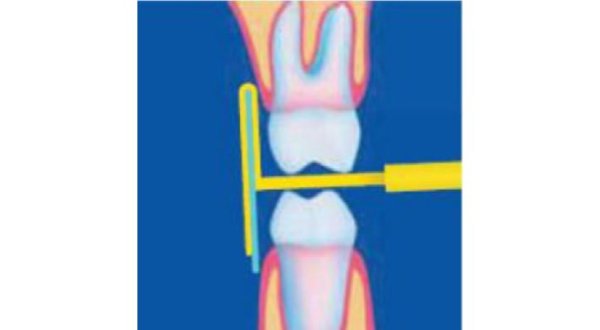 Kwik-Bite™ | Kerr Dental