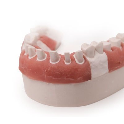Softissue Moulage™ Gingival Replication Material | Kerr Dental
