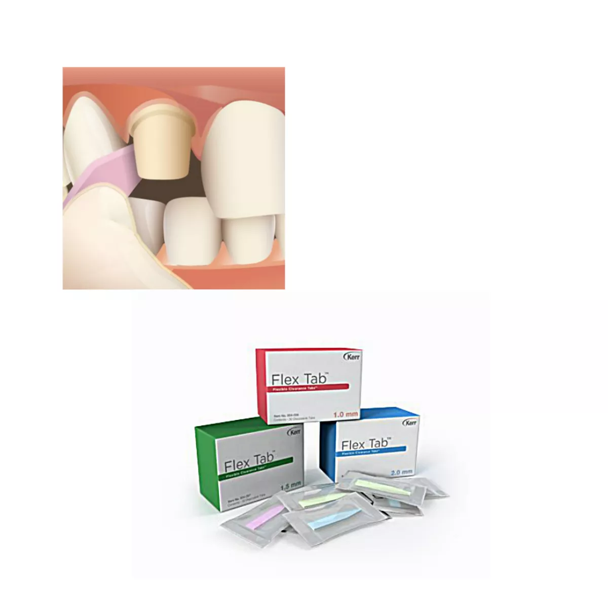 Flex Tab™ Flexible Clearance Tabs | Kerr Dental